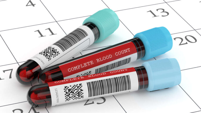 Emocromo: cos’è, i valori, quando è basso, sintomi, esame ...